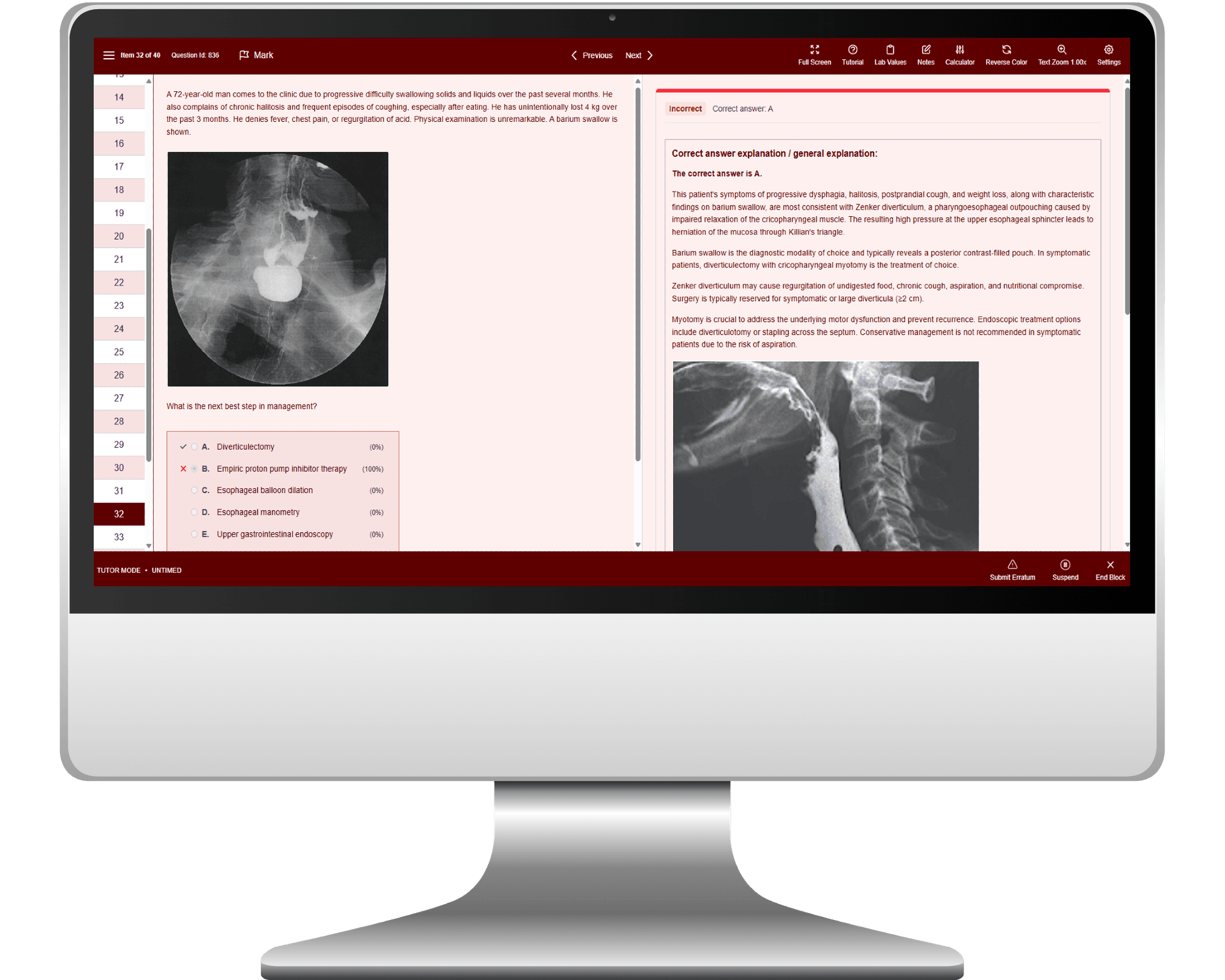 HY Internal Medicine | Mehlman Medical Question Bank